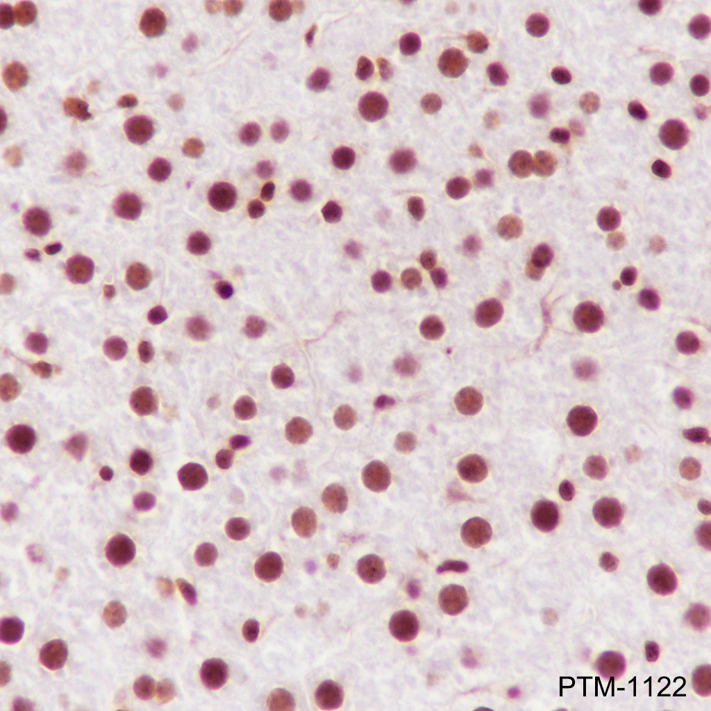 Anti-Ubiquityl-Histone H2B (Lys120) Mouse mAb - 2BScientific